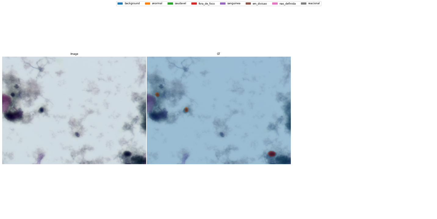 Lapix - Deep learning tutorials - HRNet with Semtorch Lapix - Deep learning tutorials - HRNet with Semtorch